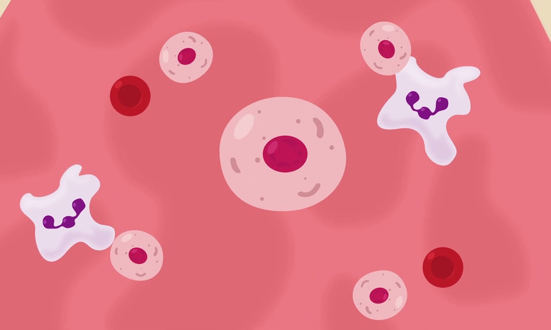 Chronische myeloïde leukemie (CML) - Hematologie-Wijzer